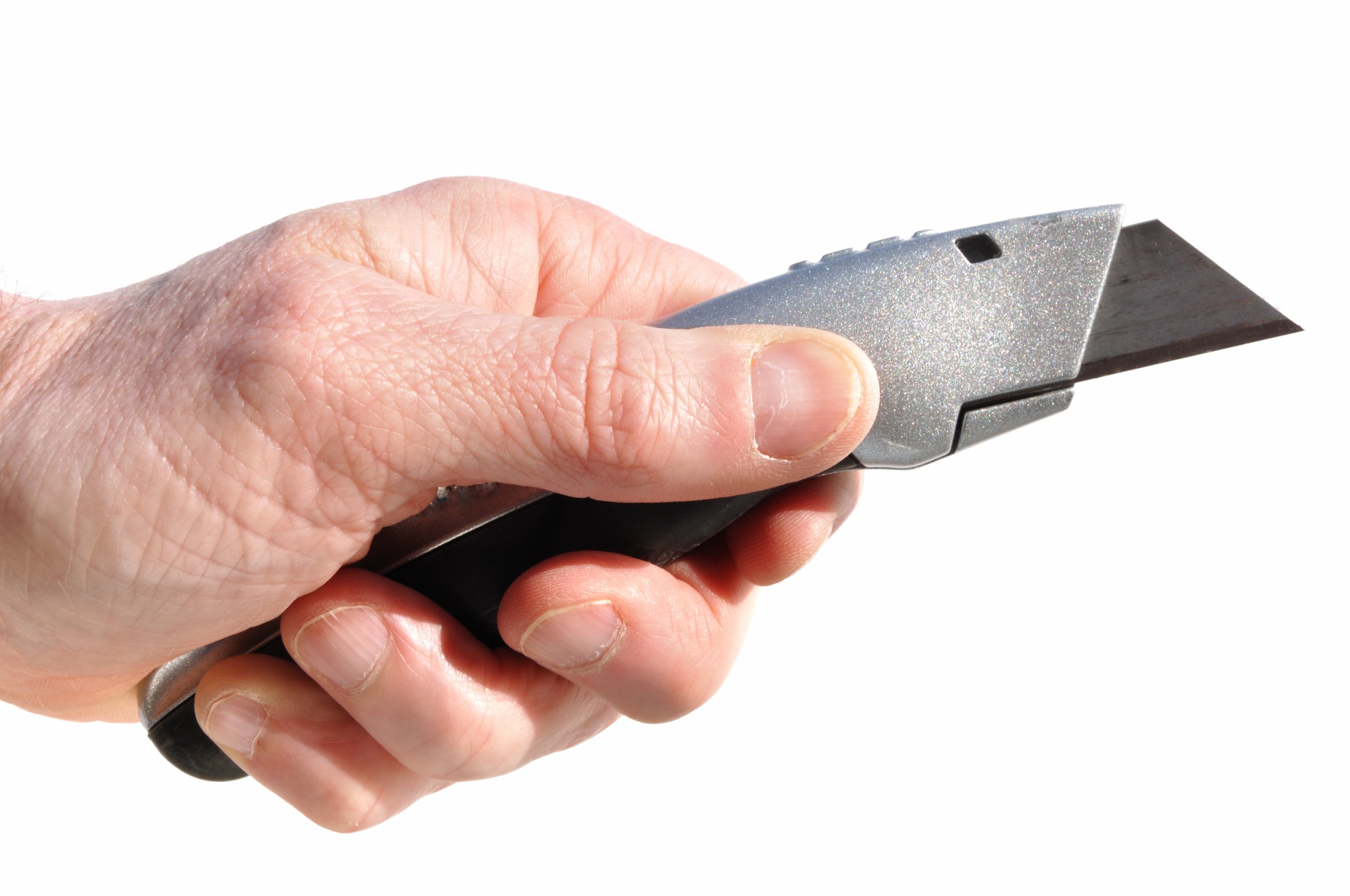 Schoolgirl Has Face Slashed 20 times with Box Cutter Schoolgirl Has Face Slashed 20 times with Box Cutter