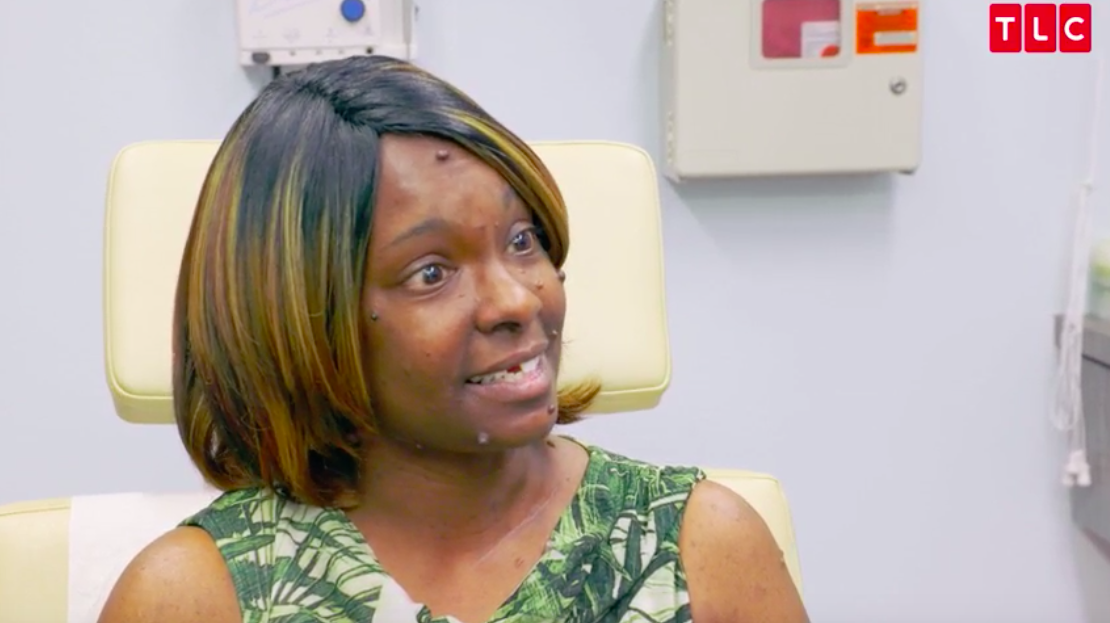 Where Is 'Dr. Pimple Popper' Subject Brittney Now? Update on Dr. Sandra ...