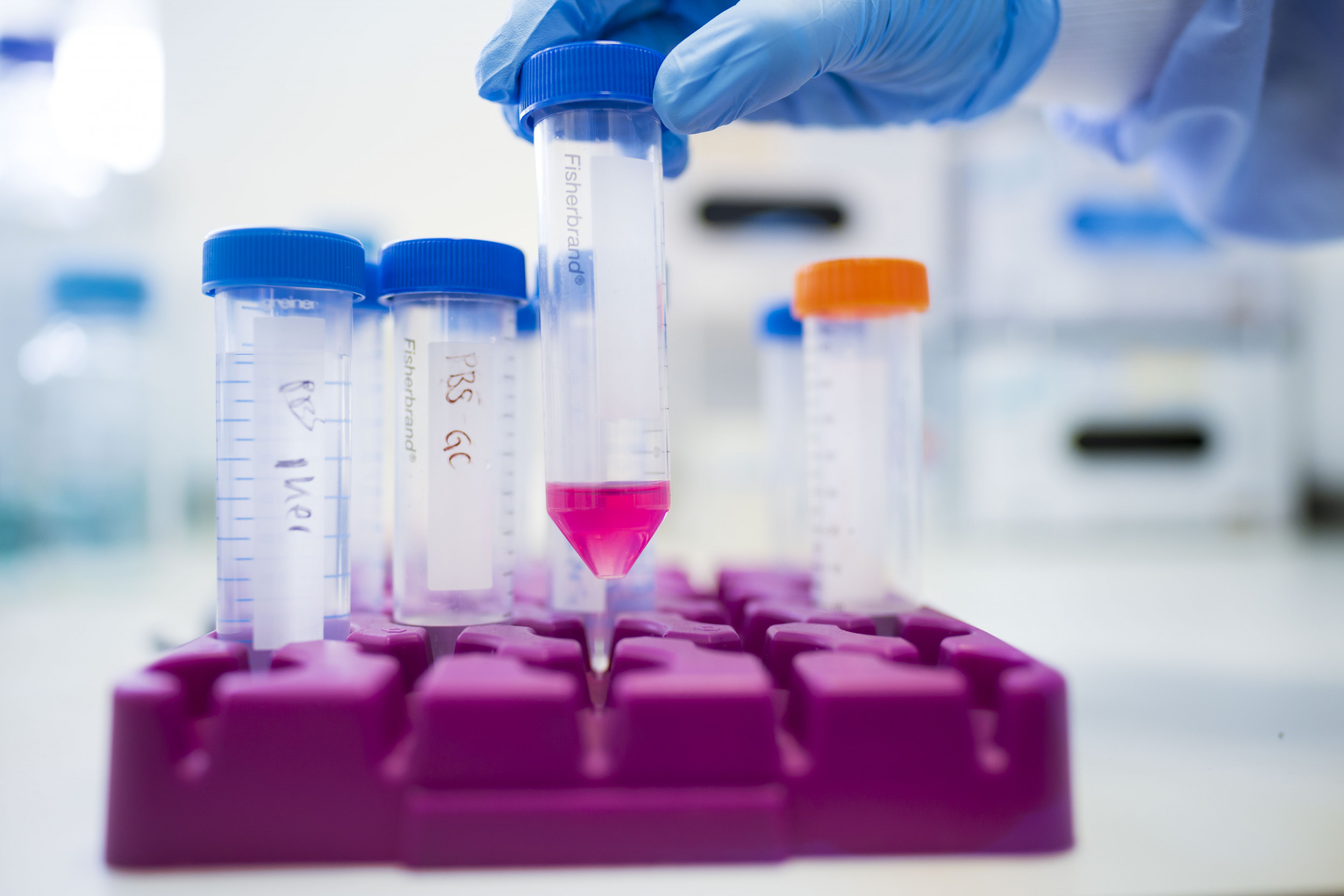 Two Strains of Flesh-Eating Bacteria Can Combine to Cause More Deadly ...
