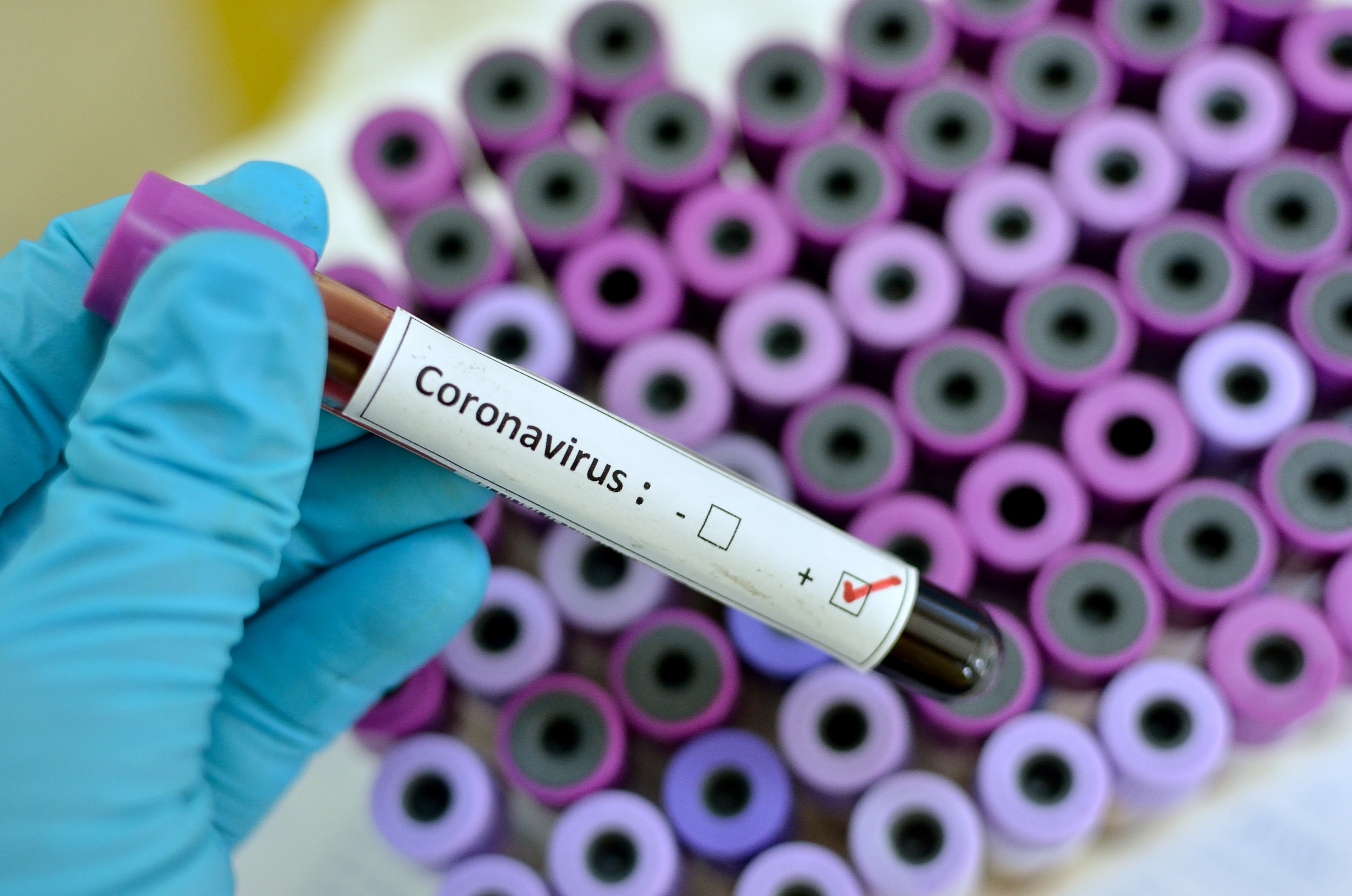 15 More Die From Coronavirus In China As Chicago Woman Treated For 15 More Die From Coronavirus In China As Chicago Woman Treated For