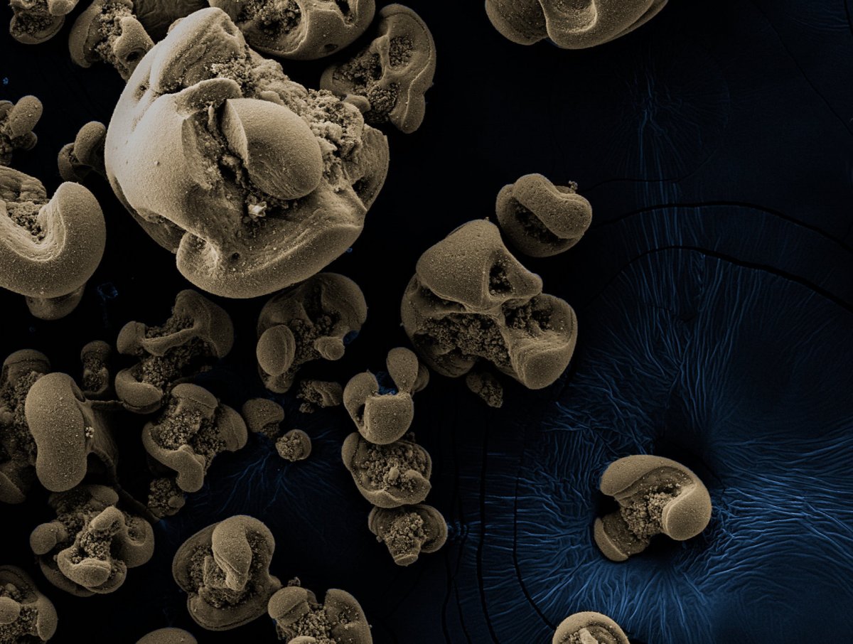 Bacteria That Feeds on Metal Accidentally Discovered by Scientists ... Bacteria That Feeds on Metal Accidentally Discovered by Scientists ...