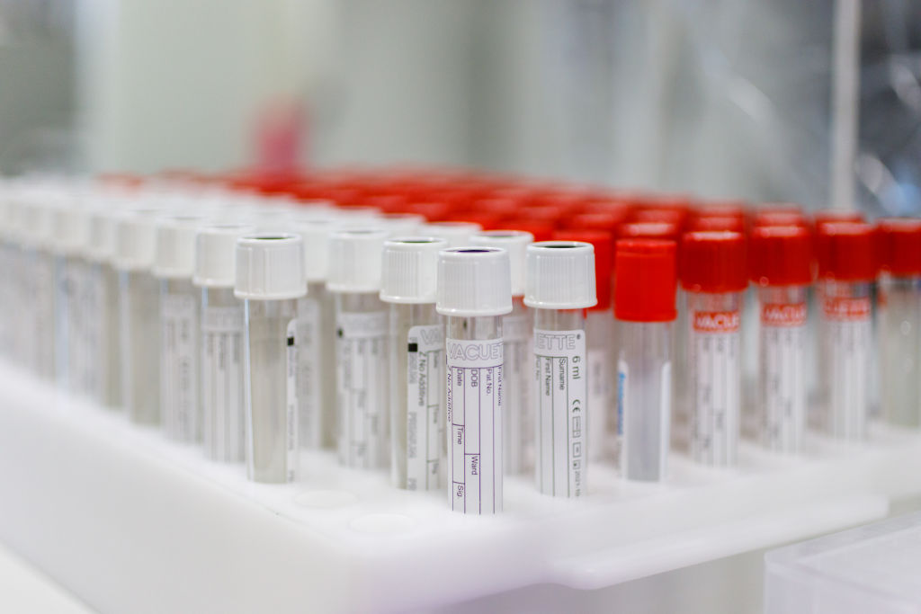 Less Than a Third of Americans Will Definitely Get the COVID Vaccine ... Less Than a Third of Americans Will Definitely Get the COVID Vaccine ...