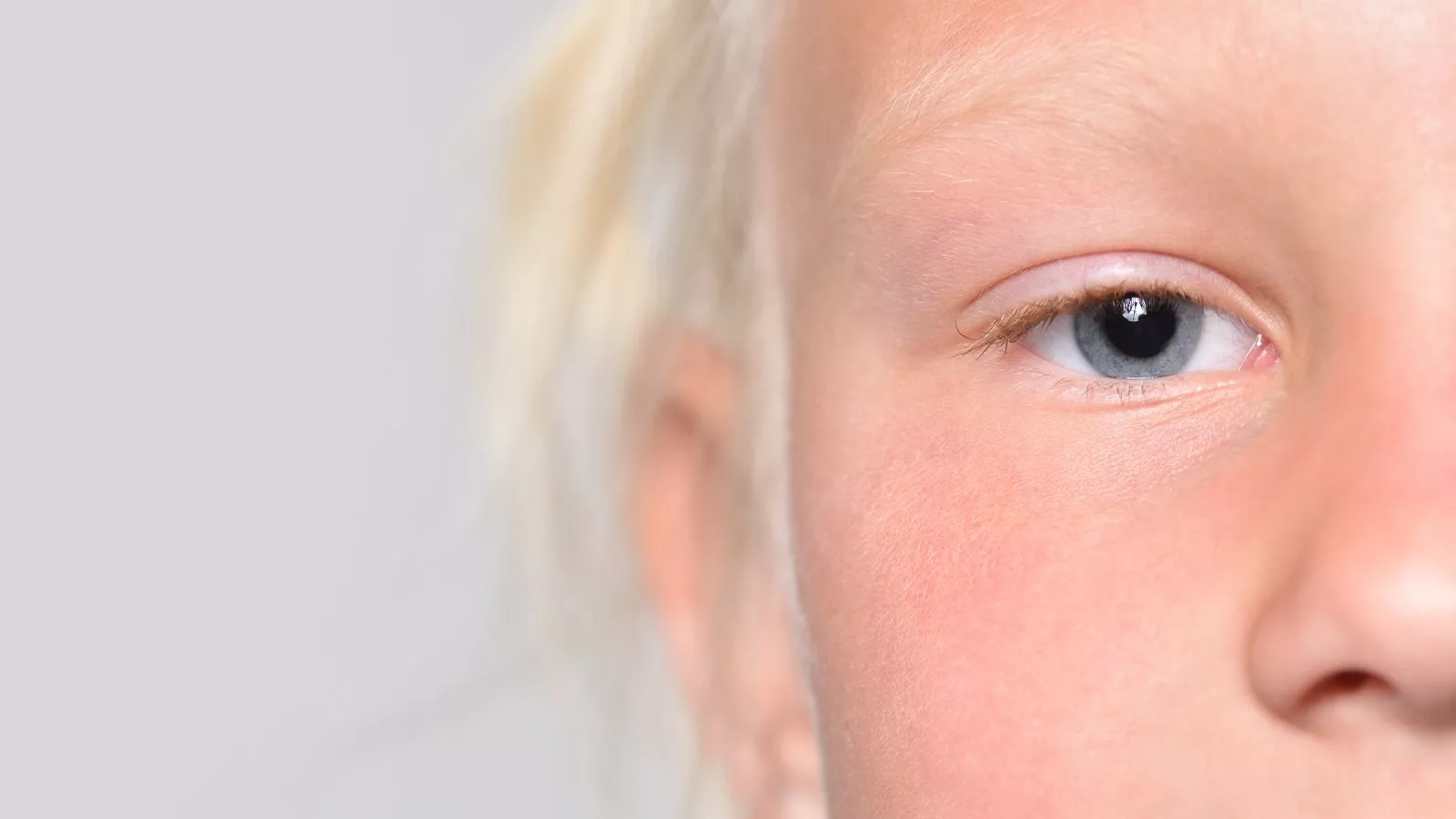 Albino Eyes Violet