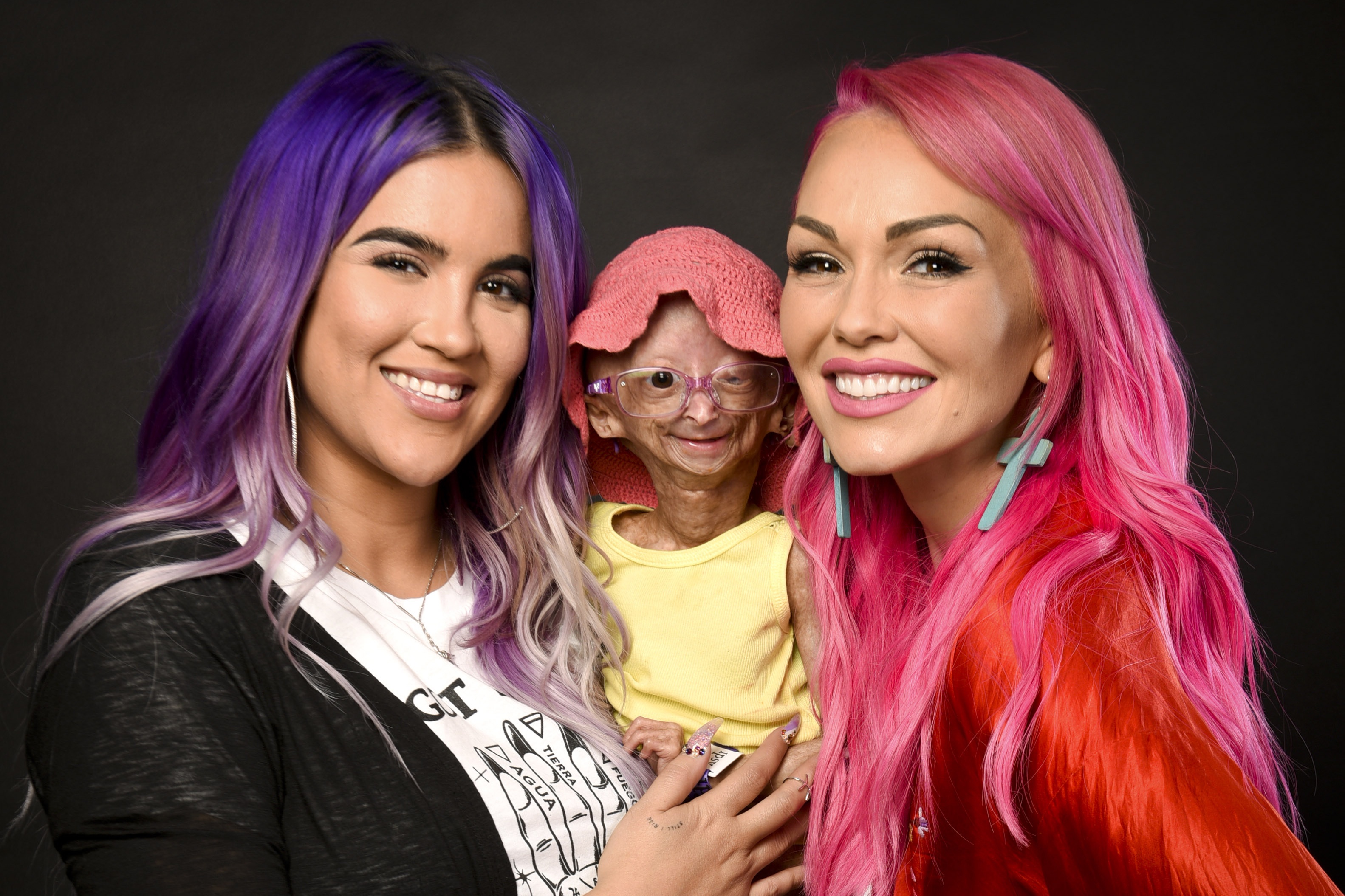 Hutchinson Gilford Progeria Syndrome Explained As YouTuber Adalia Rose Hutchinson Gilford Progeria Syndrome Explained As YouTuber Adalia Rose