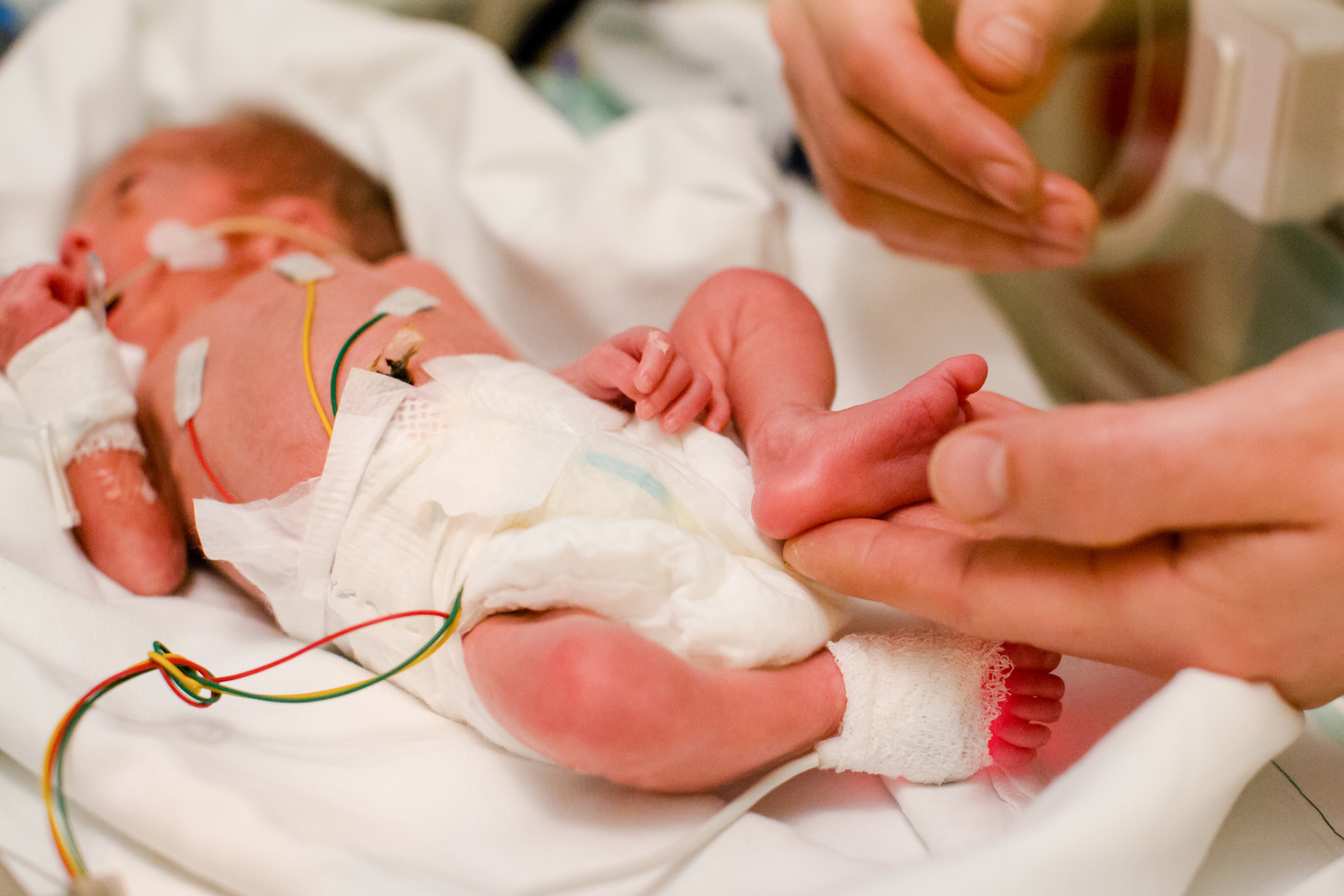Connecticut Woman Sees Man Abandoning Extremely Premature Baby On Her Car Connecticut Woman Sees Man Abandoning Extremely Premature Baby On Her Car