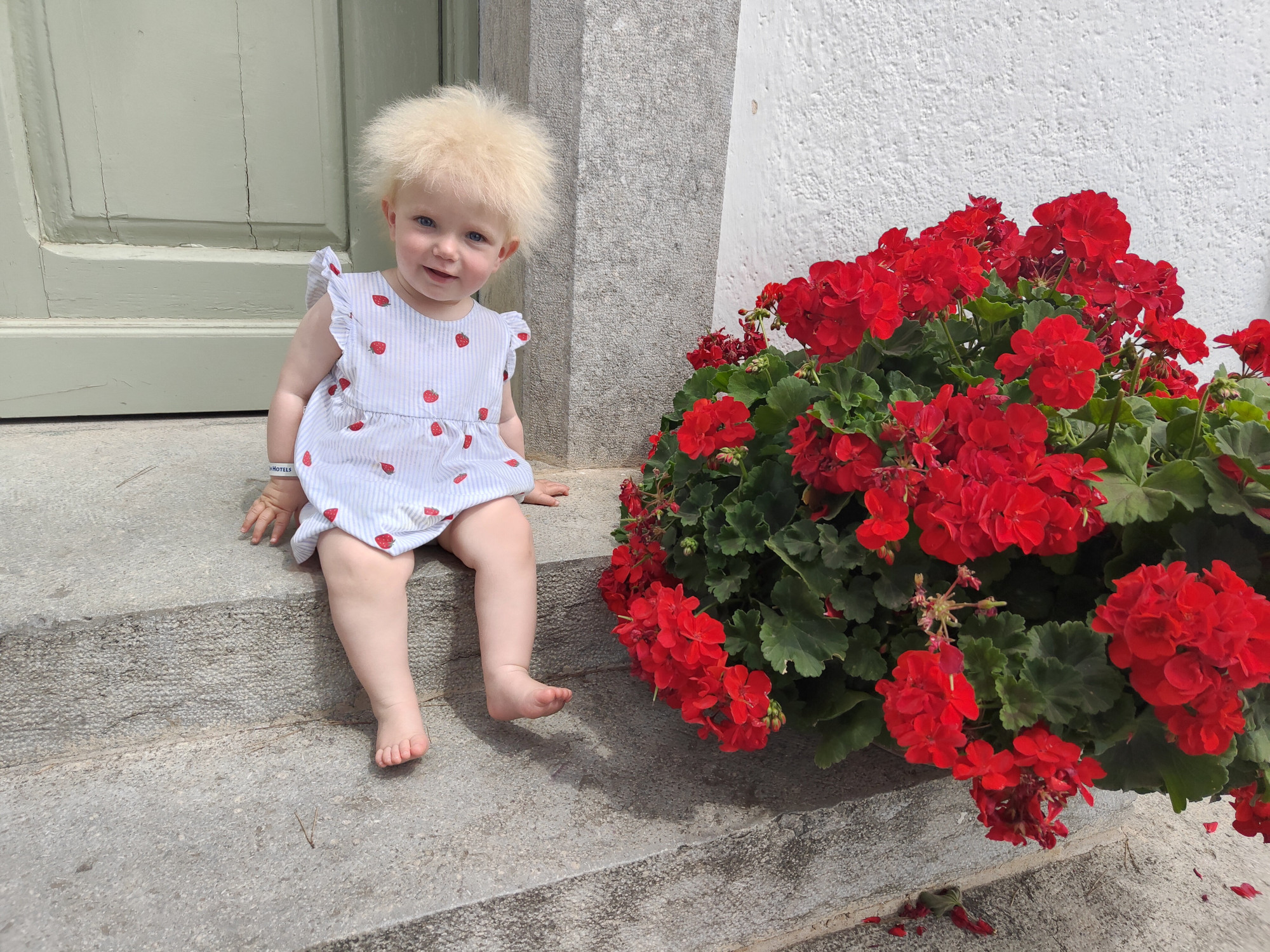Toddler With Epic Mop Diagnosed With Rare 'Uncombable Hair Syndrome ...