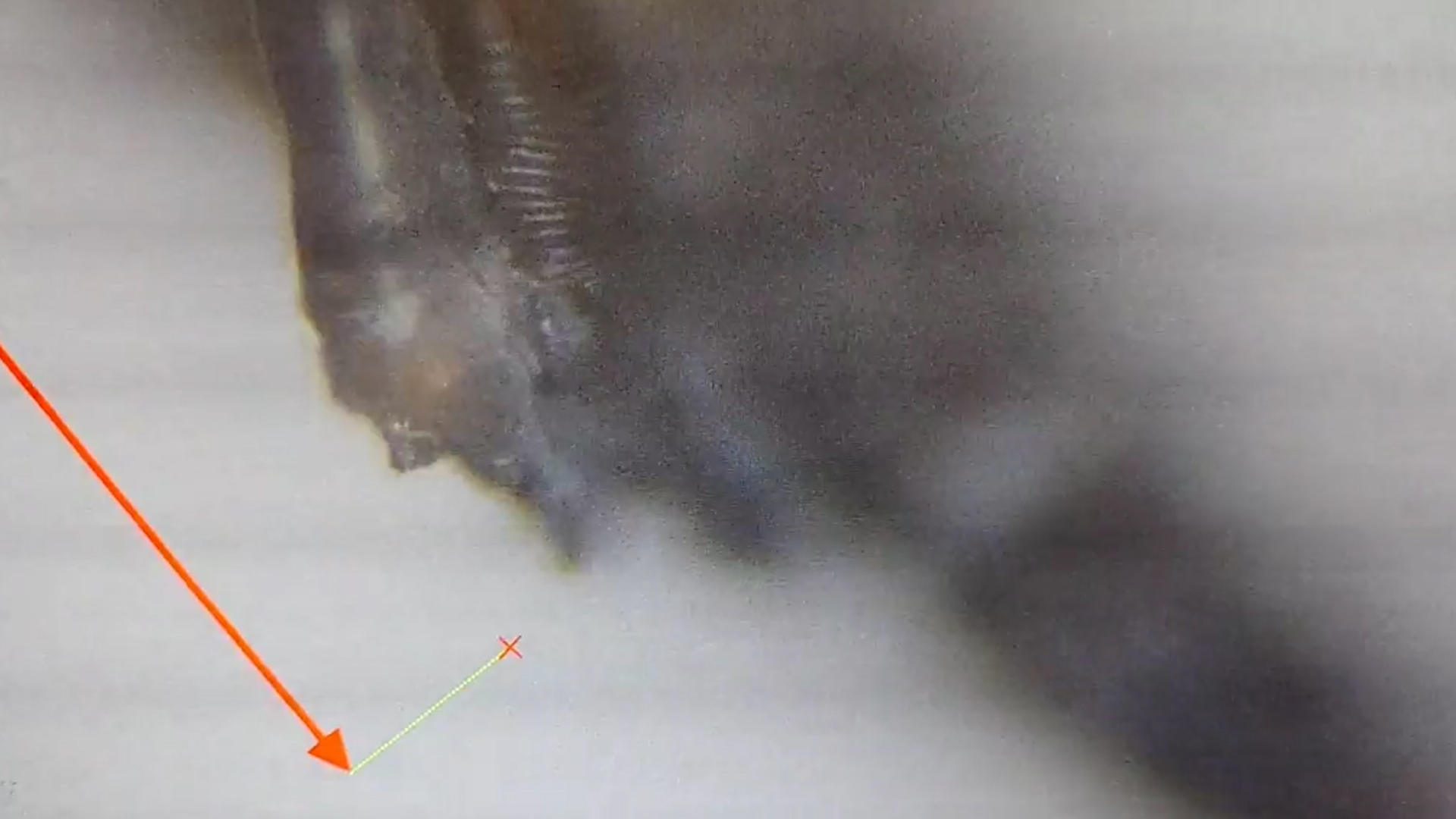 Demodex Eyelash Mites