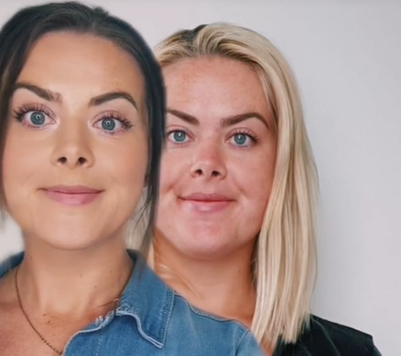 Woman Reveals How Her Puffy Face Disappeared In 4 Months Without Dieting