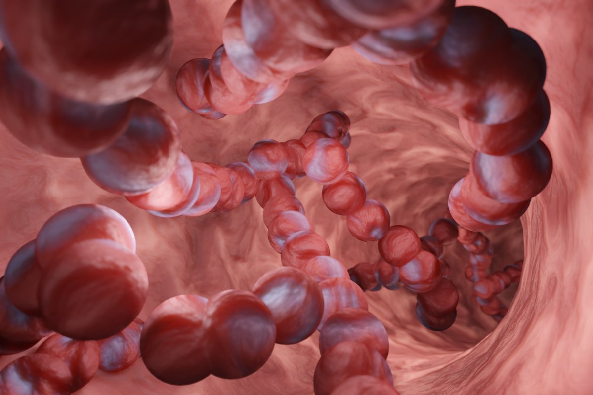 Mans Rare Flesh Eating Bacterial Infection Is Third Documented Case