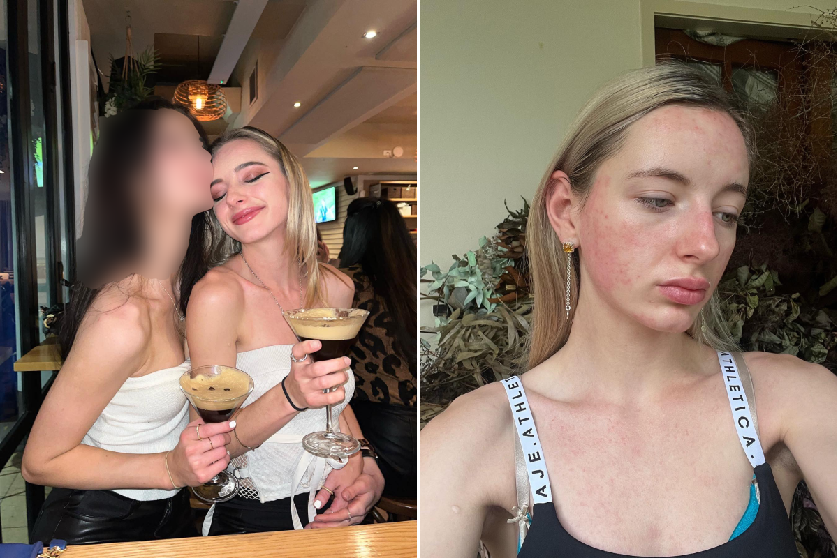 My Hangovers Got Really Bad Then Doctors Discovered The Truth my-hangovers-got-really-bad-then-doctors-discovered-the-truth
