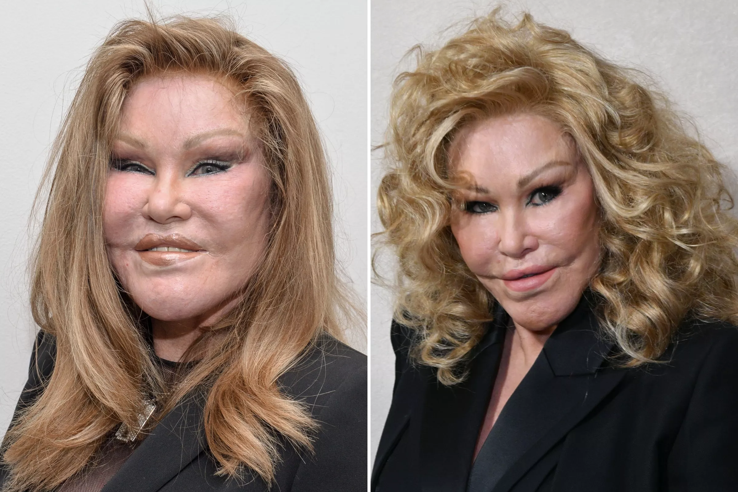 Jocelyn Wildenstein 2024 New Face She Was Cold And She Was Dead':