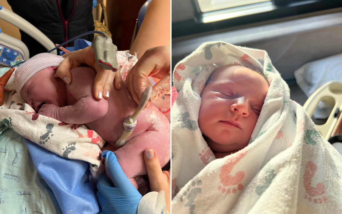 Umbilical Cord Cord Care What You Need To Know