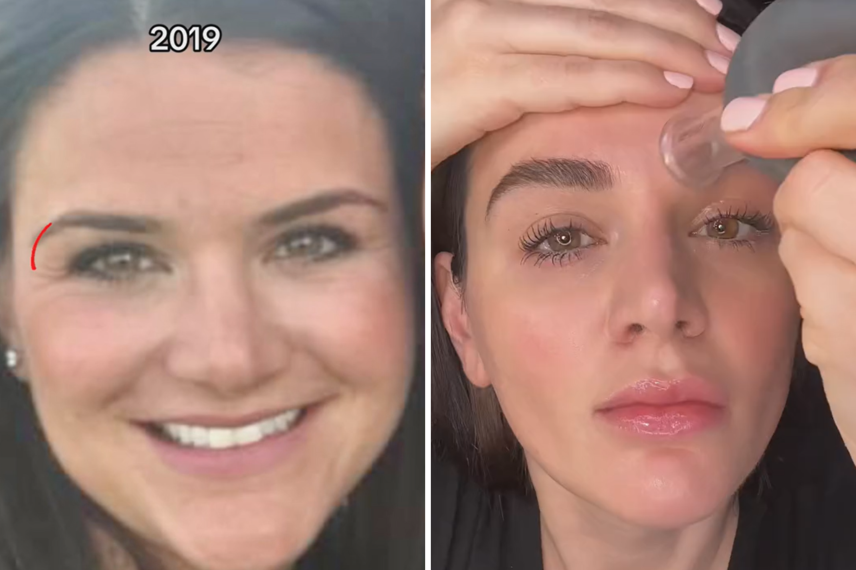 Woman s Technique to Get Rid of Hooded Eyelids Naturally Goes Viral Newsweek