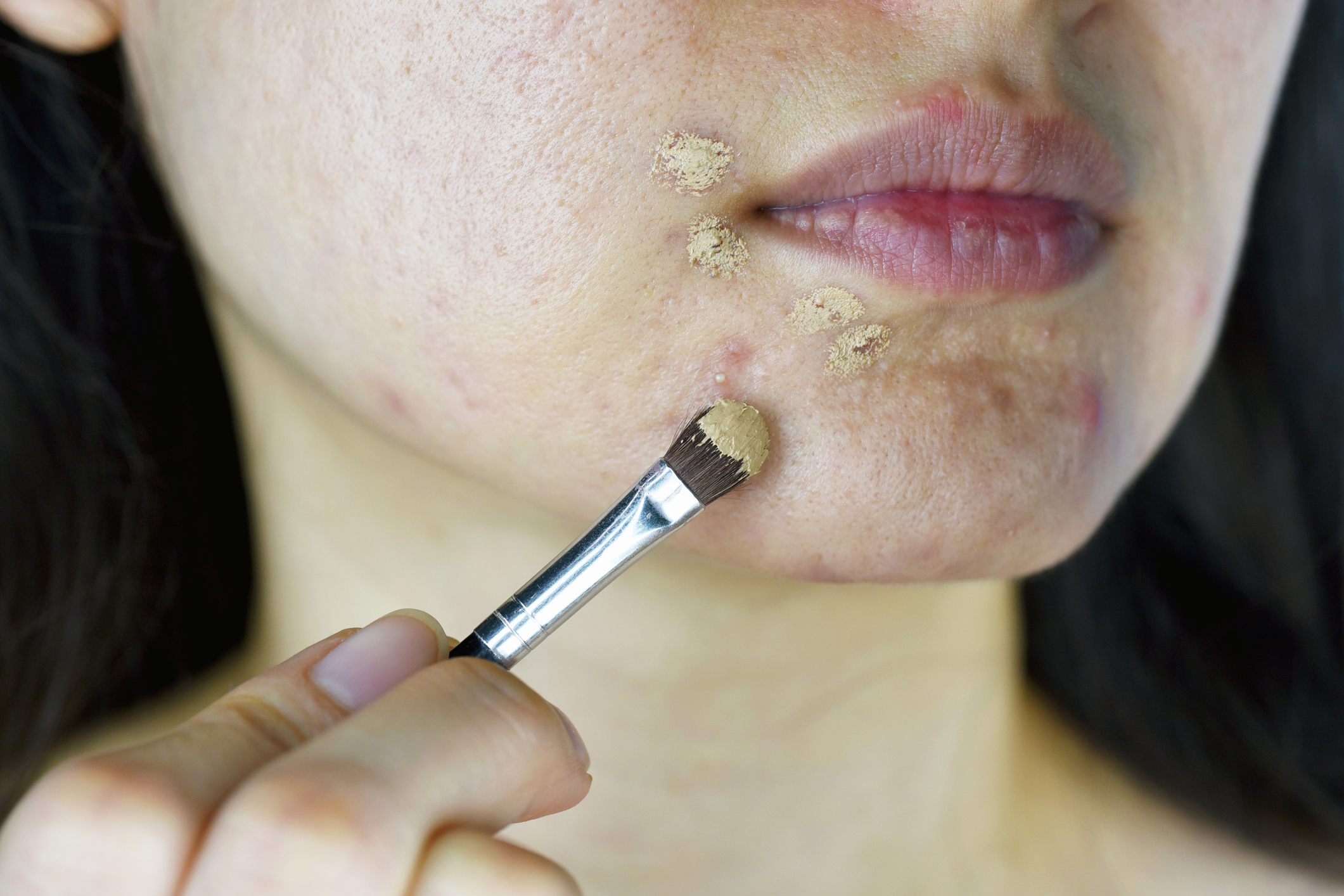 How to Use Makeup Safely When You Have Acne, According to an ...