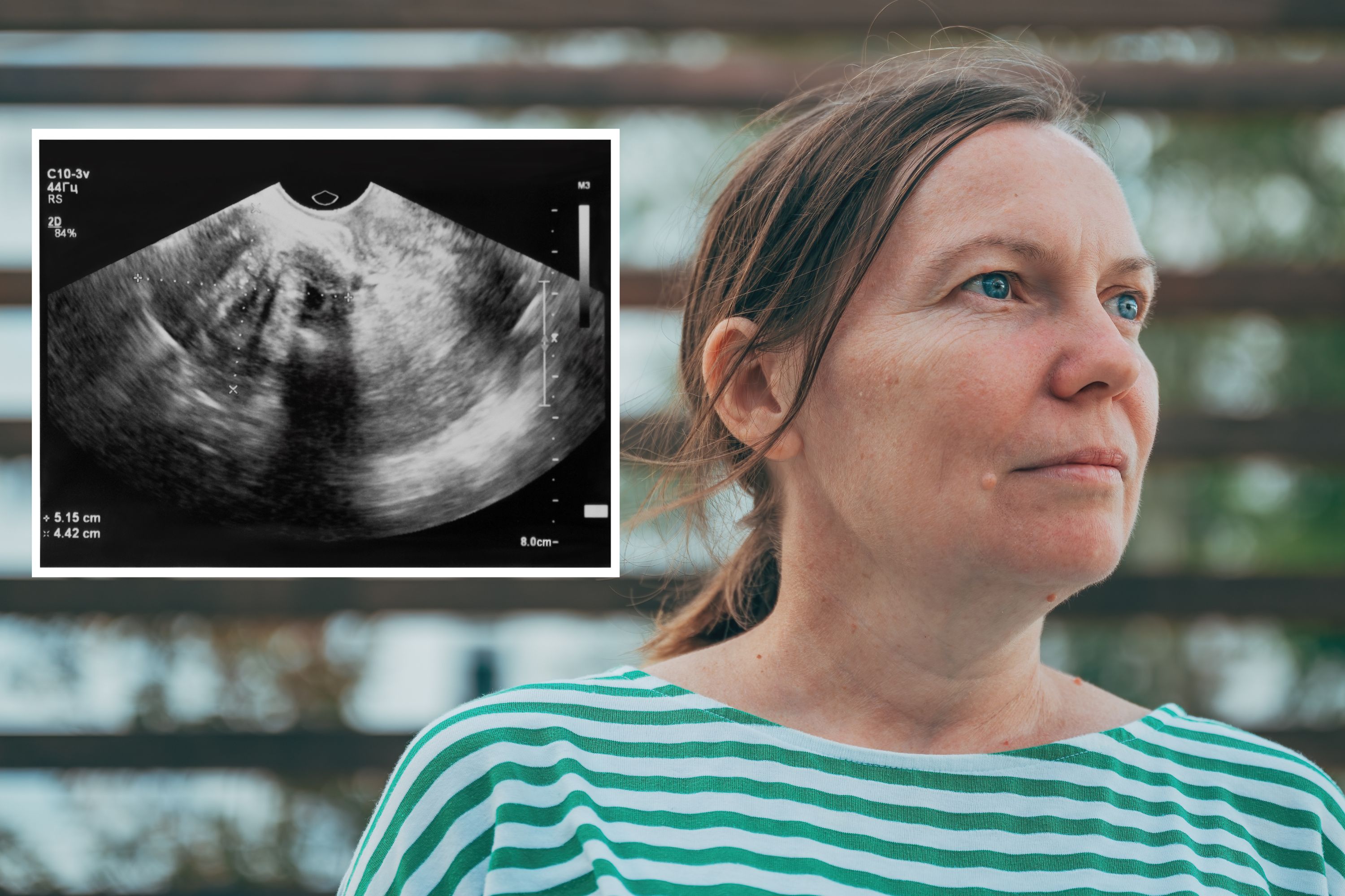 Mom's Reply to Daughter-in-Law Wanting to Use Name of Her Late Baby Cheered - Newsweek