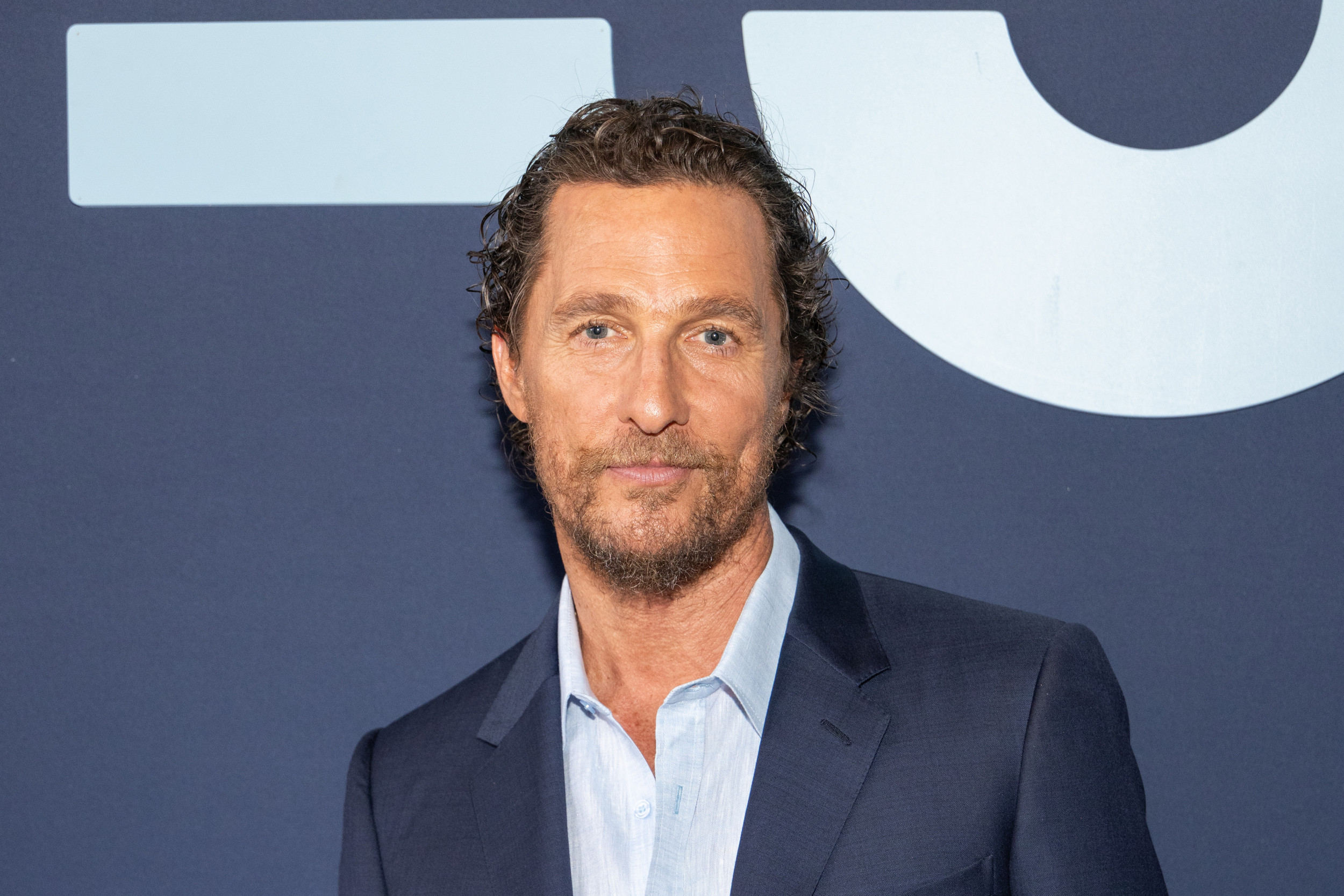 Matthew McConaughey Shares Jarring Photo of Swollen Eye - Newsweek