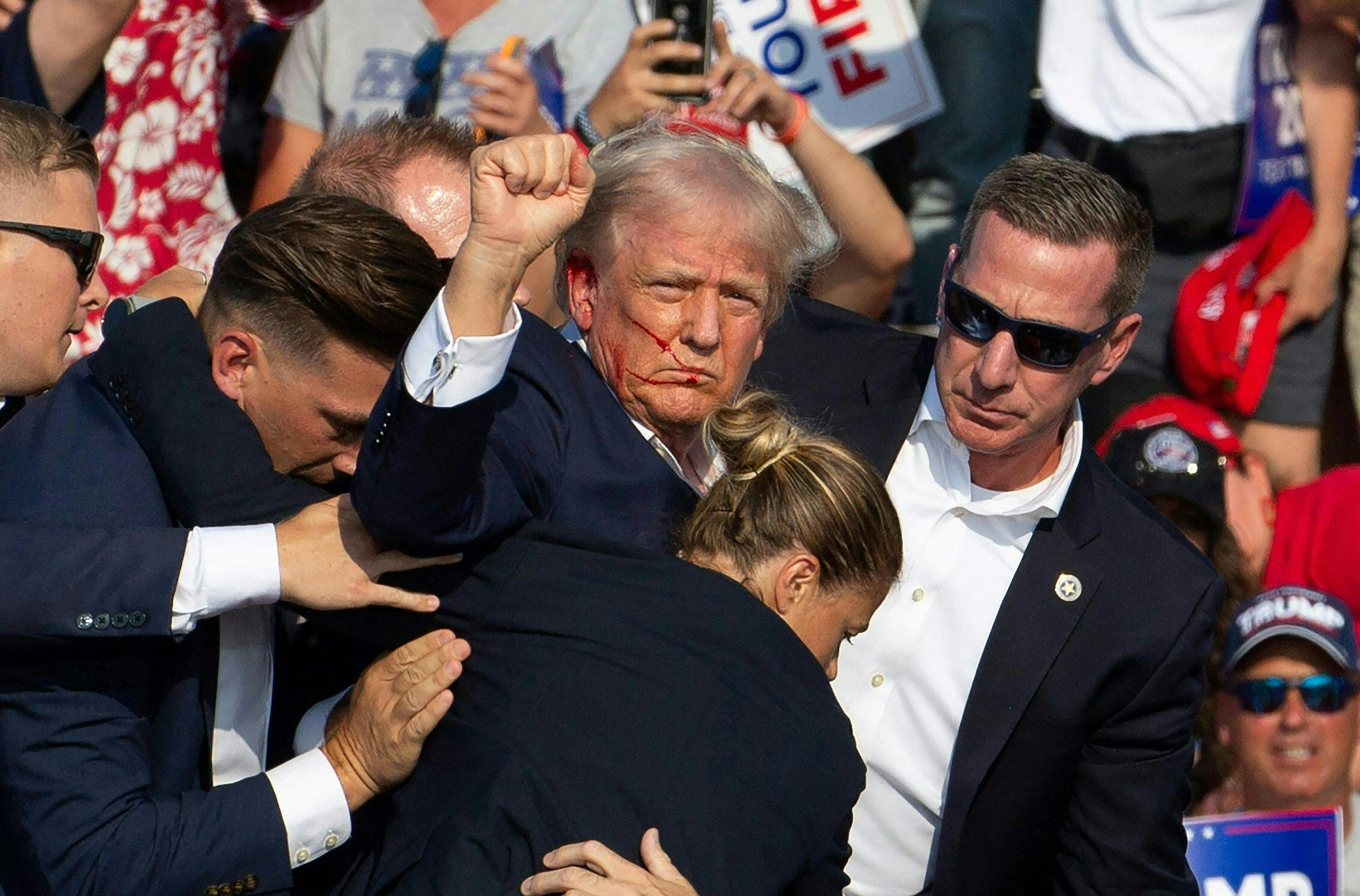Donald Trump Reveals Interaction With Doctor After Shooting: 'Miracle ...
