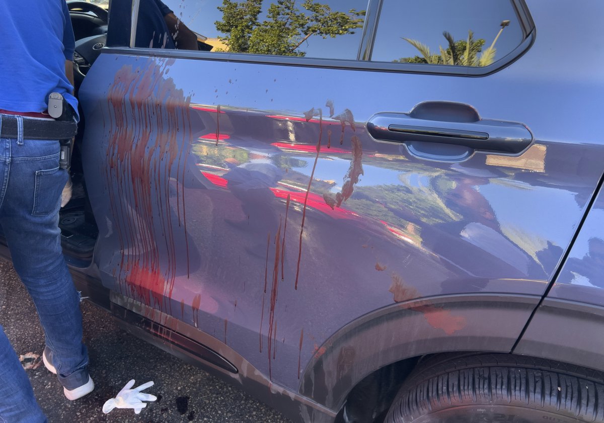 Exploding Pagers Kill 9 and Injure Thousands in Lebanon—Israel Blamed ... Exploding Pagers Kill 9 and Injure Thousands in Lebanon—Israel Blamed ...