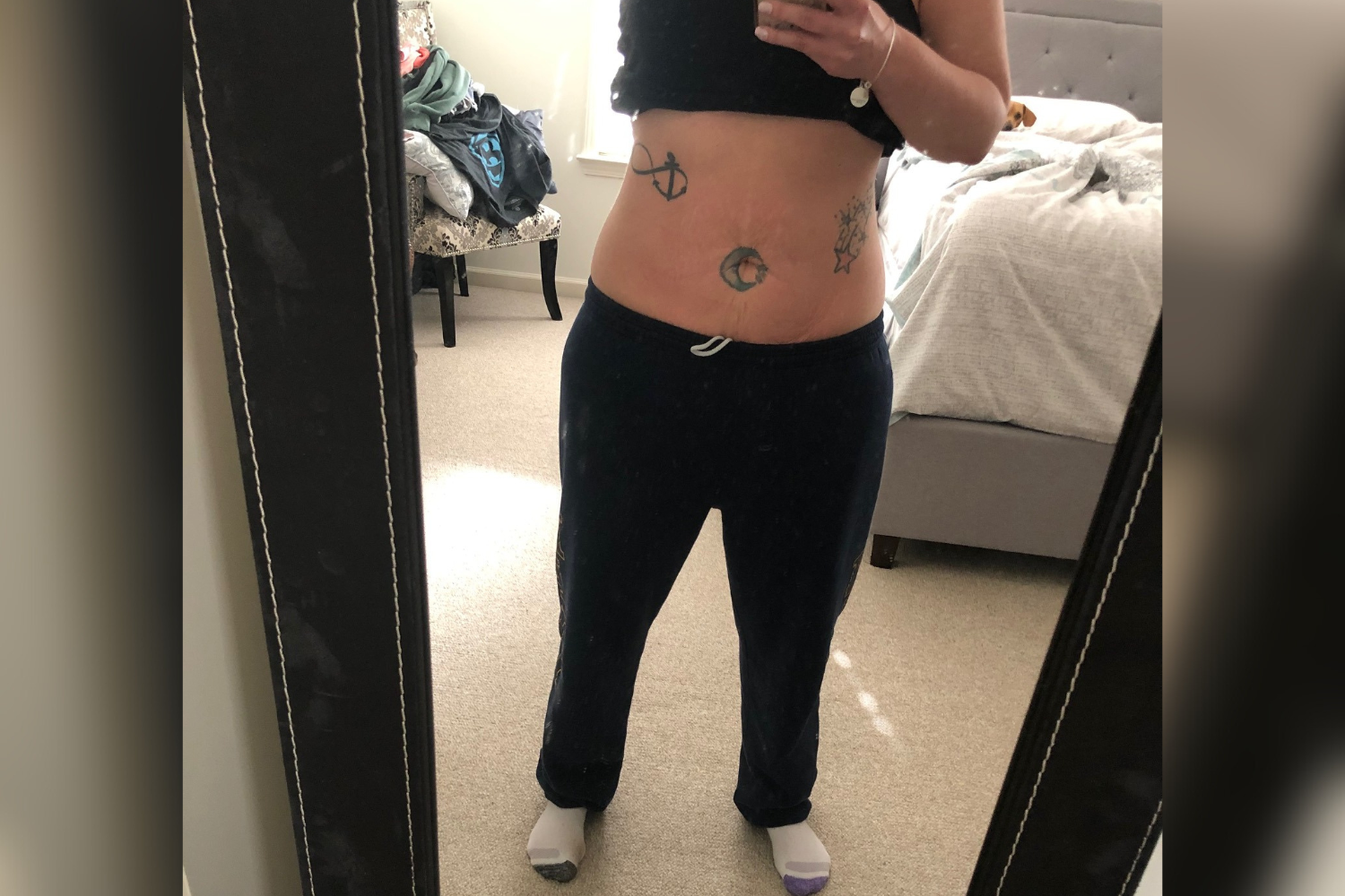 Woman With Belly Button Tattoo Gets Tummy Tuck, Here's Where It Ends Up ...