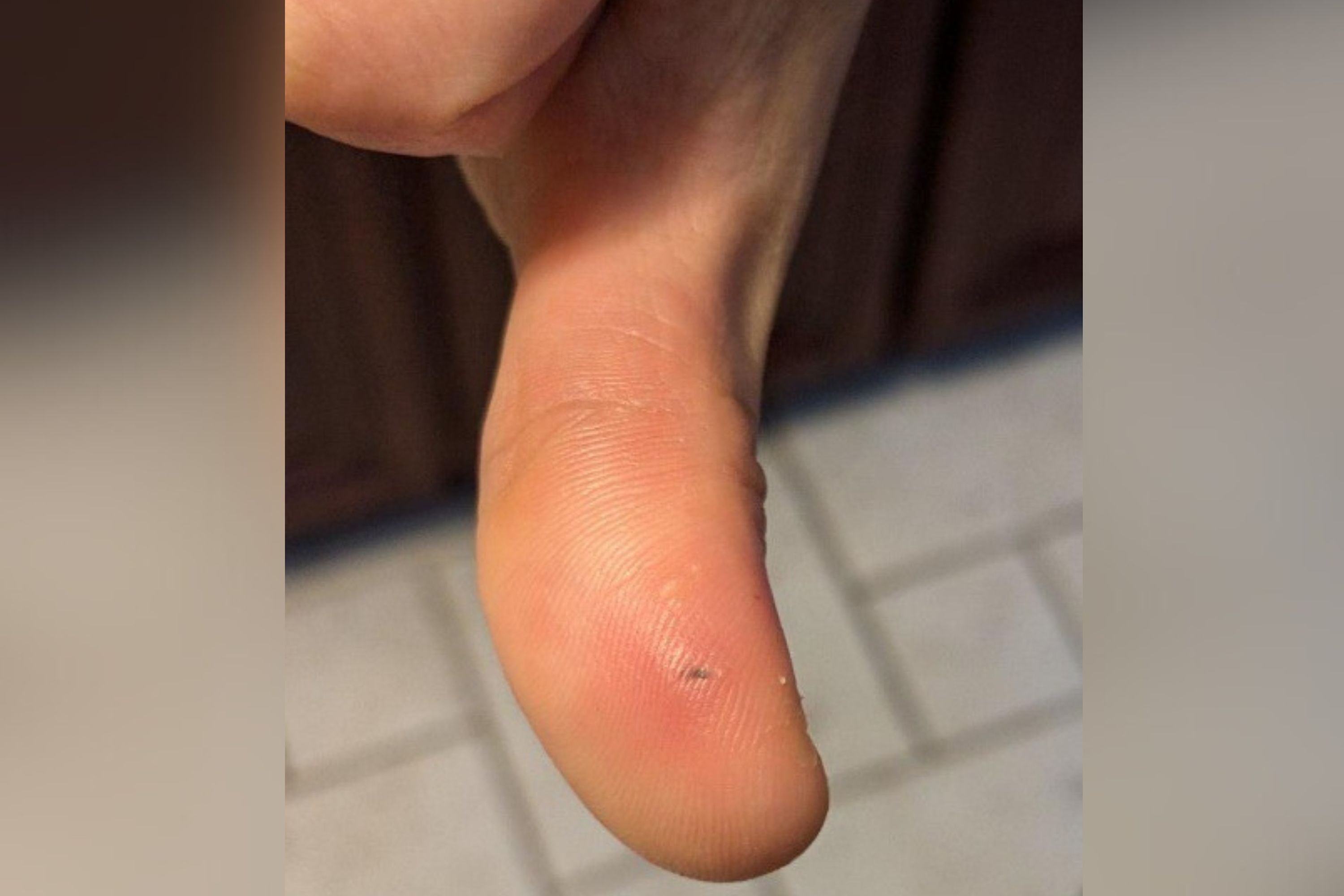 Woman Forced to Pay $400 for Hospital to Remove Splinter From Onion - Newsweek