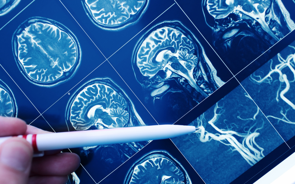 Woman Backed for Not Telling Ex-Husband About 'Life Changing' Illness ...