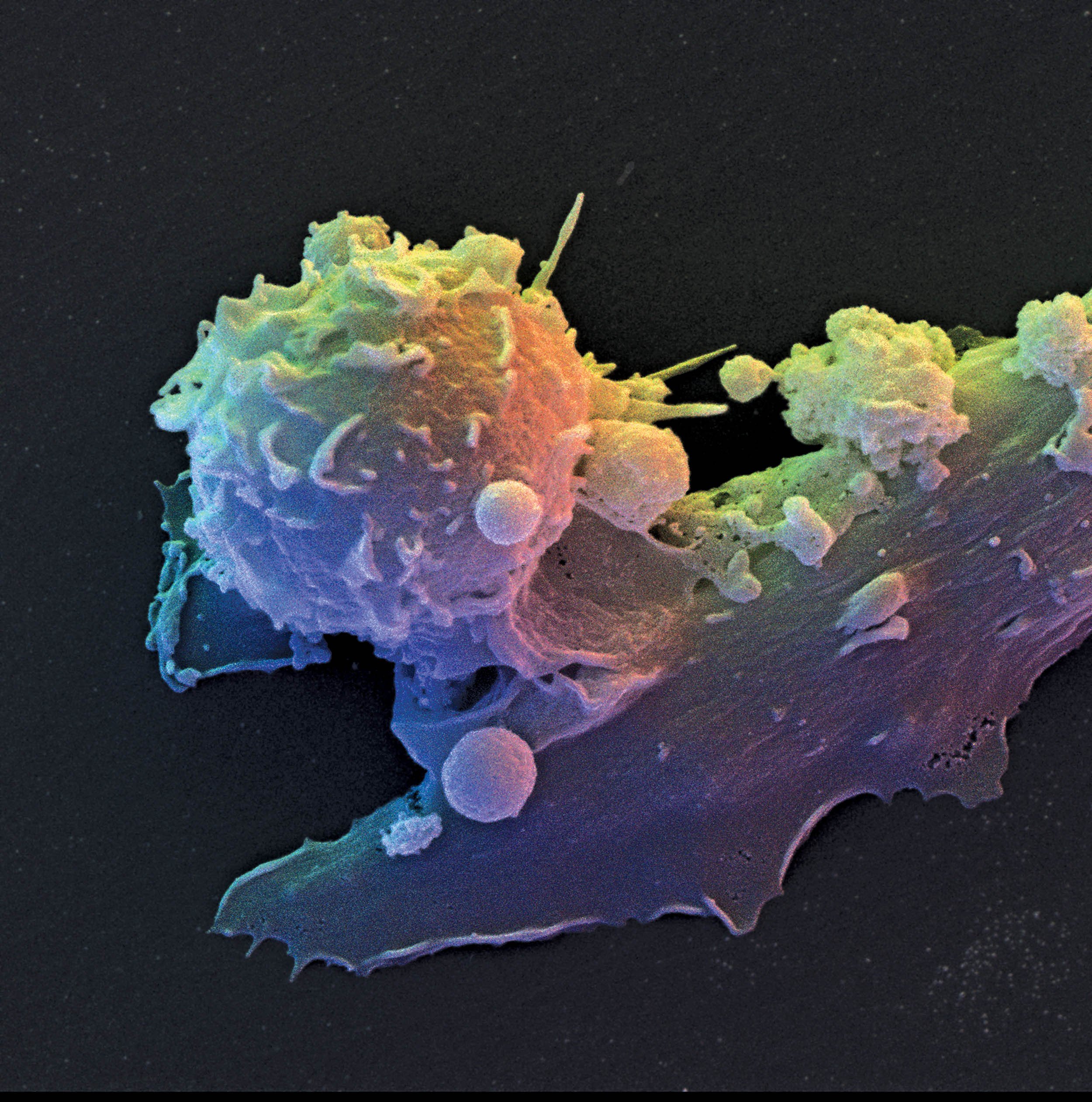 The Mystery of the Elite Controller and How We Will Cure HIV - Newsweek