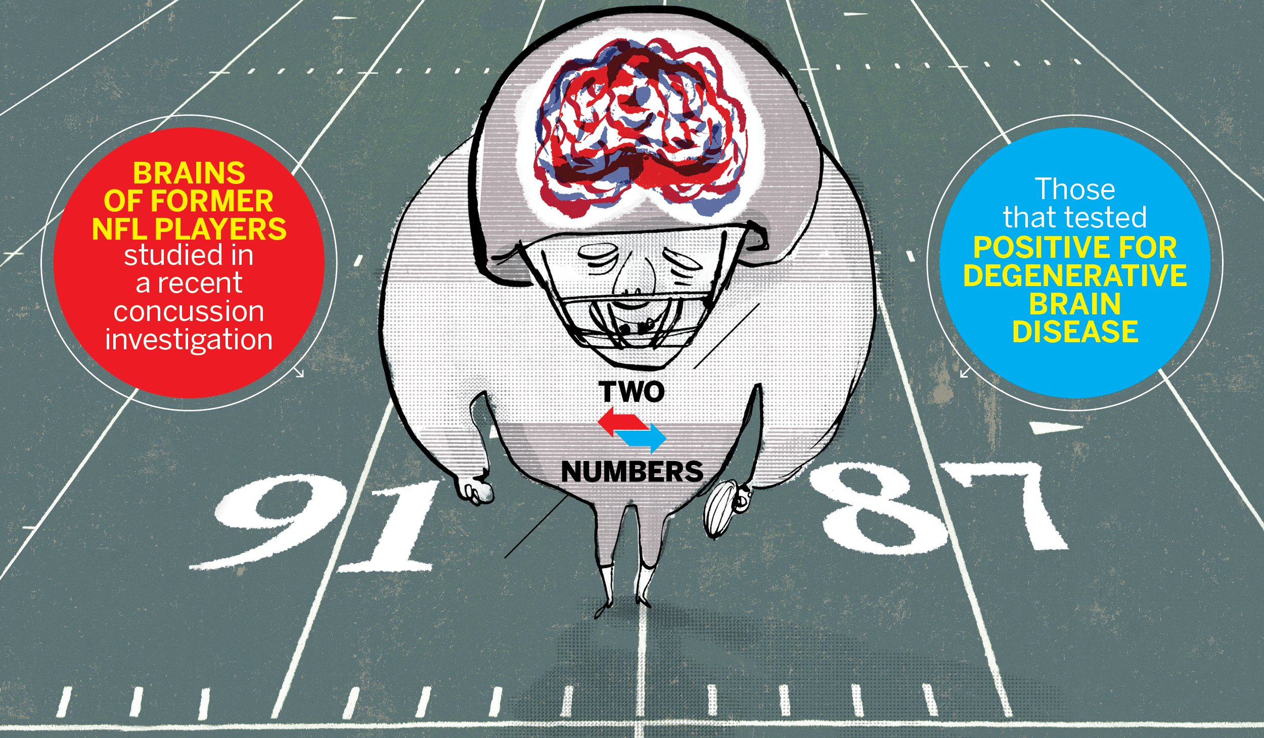 Two Numbers: Degenerative Brain Disease Nearly Universal Among NFL ...